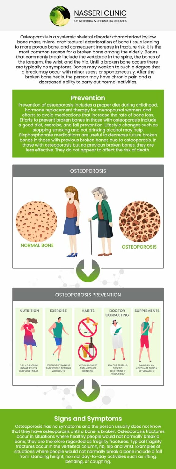 Osteoporosis Treatment Specialist | Dr. Nasseri, MD