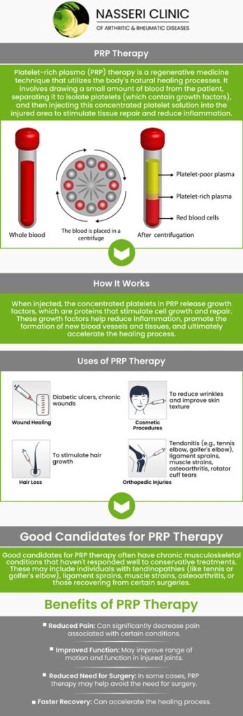 Before and After PRP Therapy for Joints | Dr. Nasseri